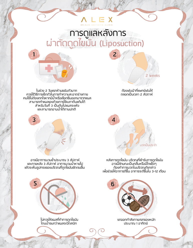 Belly Liposuction - DR.ALEX