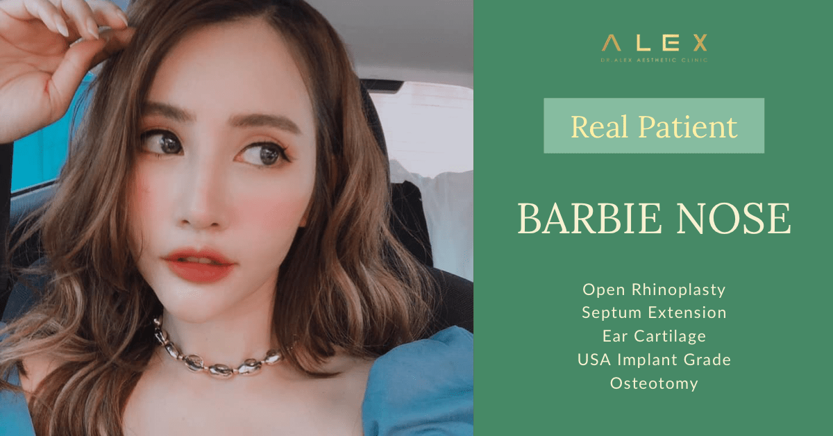 BARBIE NOSE | แก้จมูกที่ไหนดี แก้จมูกเทคนิคไหนดี มาดูกัน - DR.ALEX
